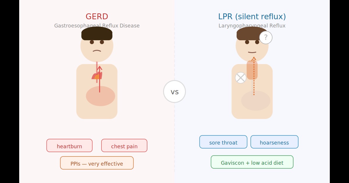 GERD vs LPR: What's the Difference and Which One Do You Have?